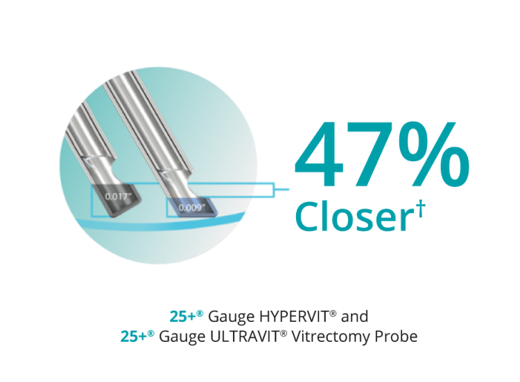 Constellation® Vision System | Alcon UK